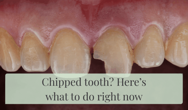 Chipped tooth? Here’s what to do right now - Stellenwerf Dental Studio
